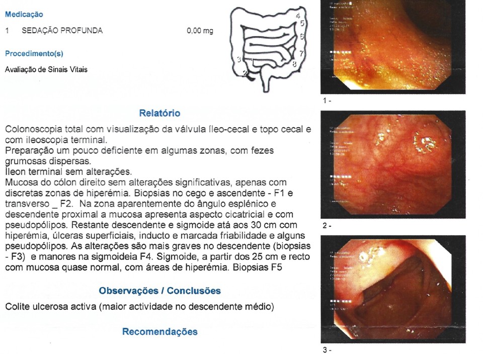 Colonoscopia - Vencer a Colite